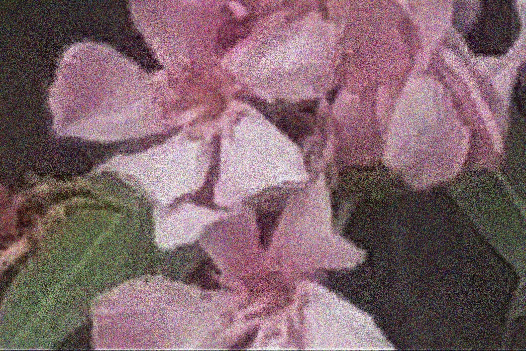 Why I See Life in 480p – An Exploration of Visual Snow Syndrome ...